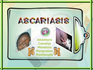 Ascariasis Case Presentation | PPT