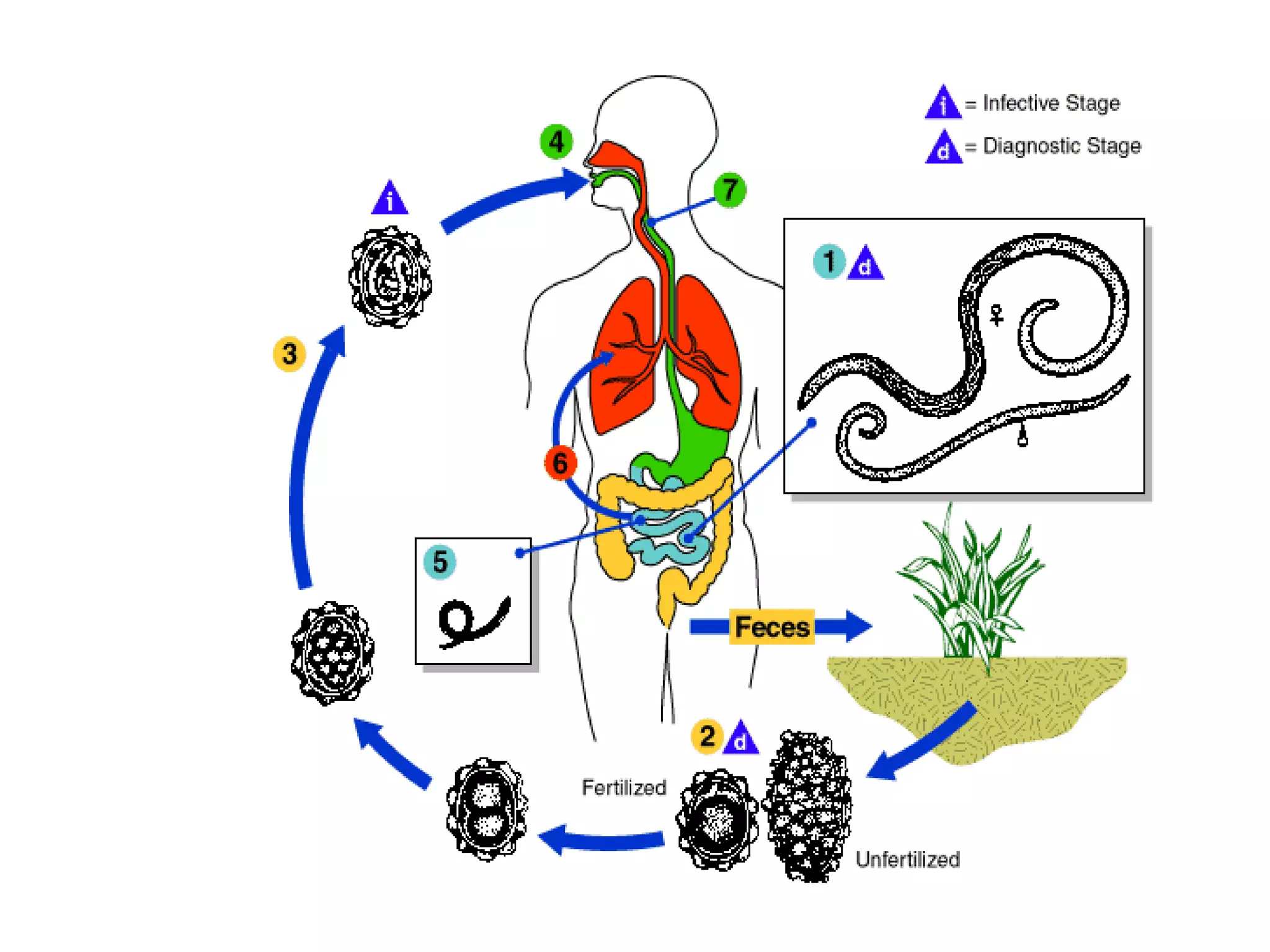 Ascariasis | PPTX | Digestive Disorders | Diseases and Conditions