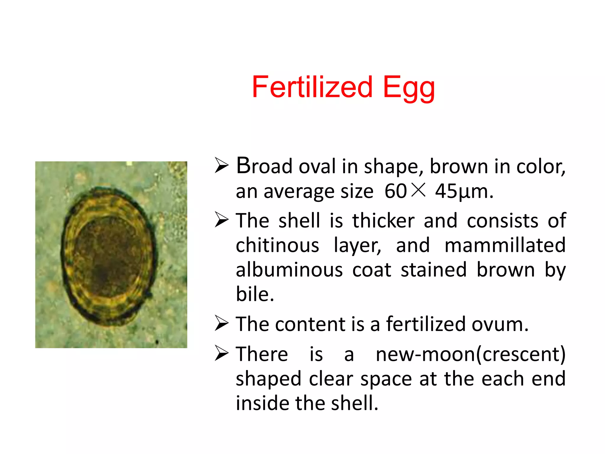 Ascariasis | PPTX