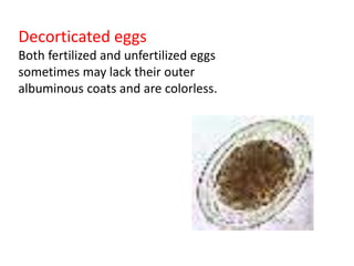 Ascaris Lumbricoides Decorticated Egg