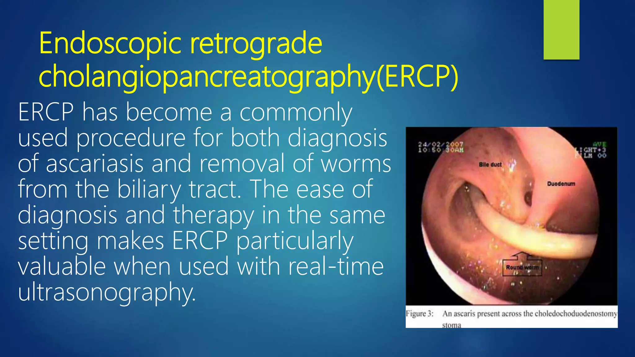 Ascariasis | PPTX