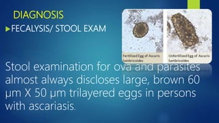 Ascariasis | PPTX