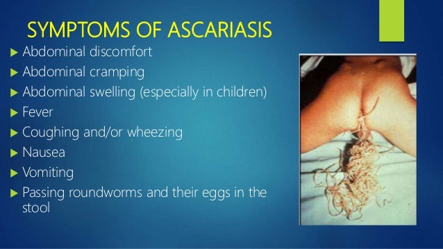 Ascariasis Causes Symptoms Signs Diagnosis Treatment