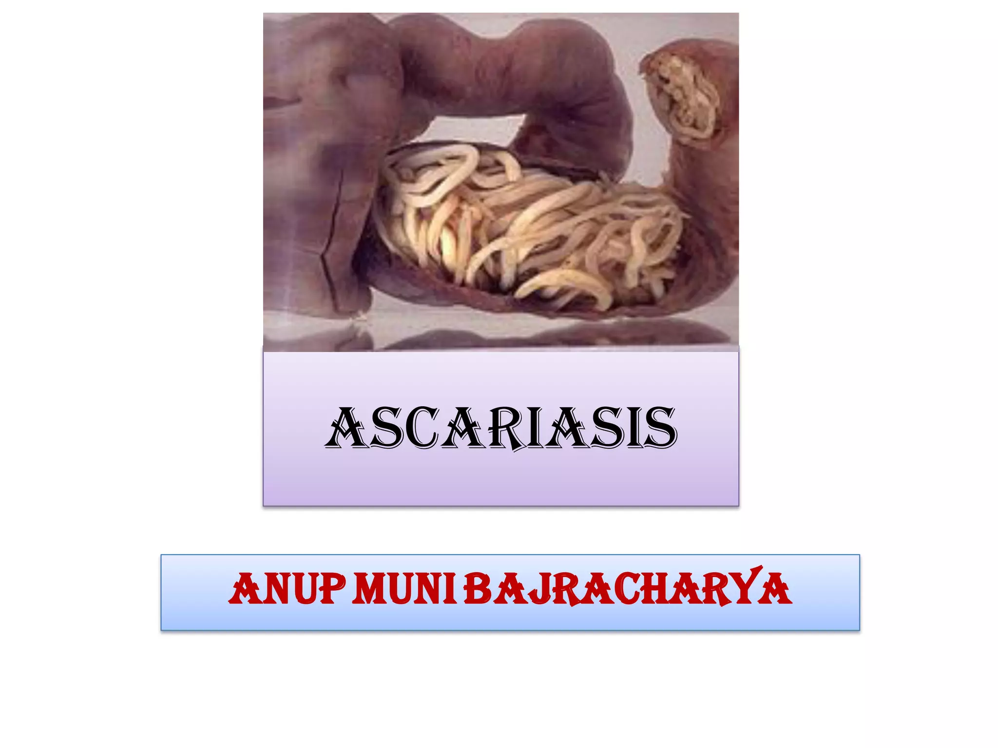 Ascariasis- Roundworm Infection | PDF
