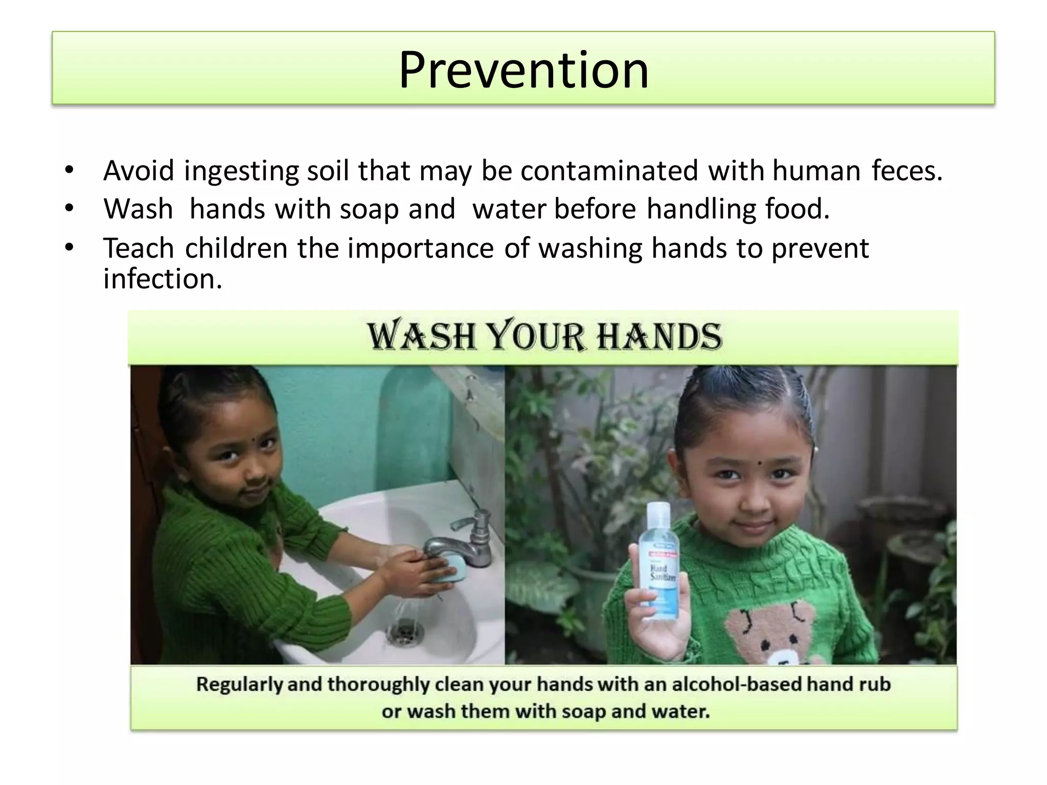 Ascariasis- Roundworm Infection | PDF