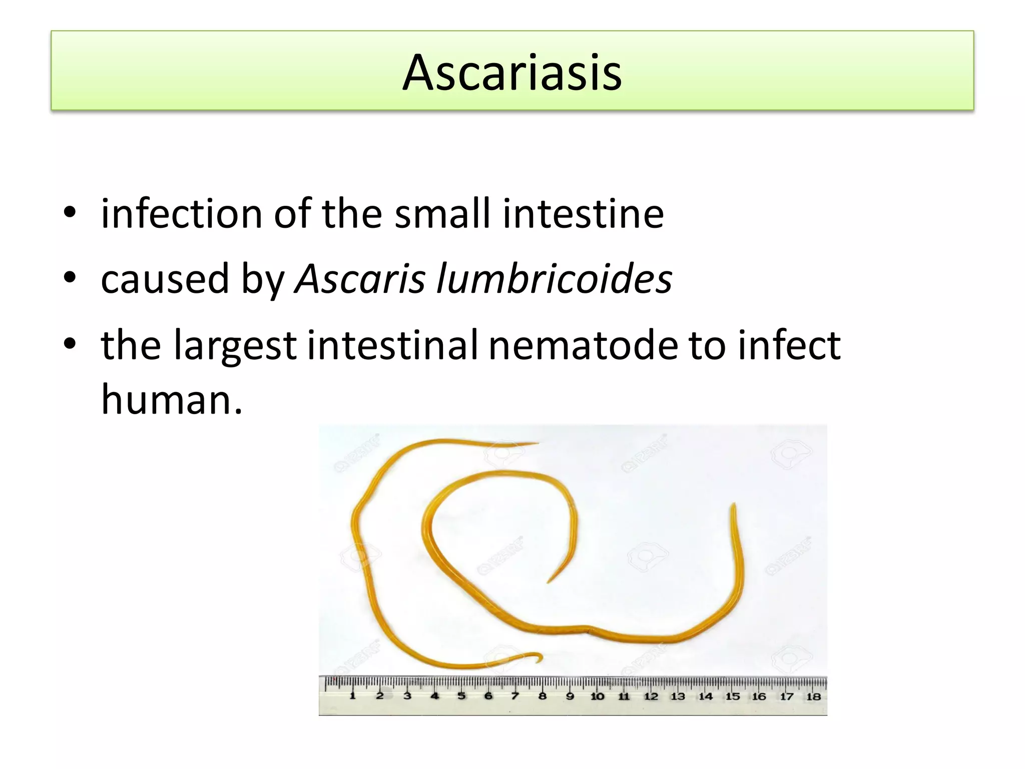 Ascariasis- Roundworm Infection | PDF
