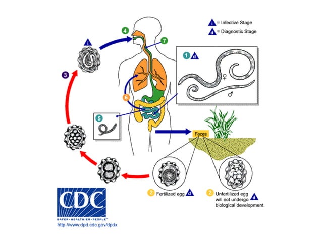 Ascariasis- Roundworm Infection | PDF | Infectious Diseases | Diseases ...