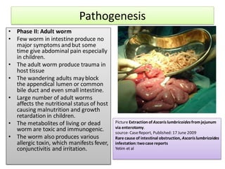 Ascariasis- Roundworm Infection | PDF