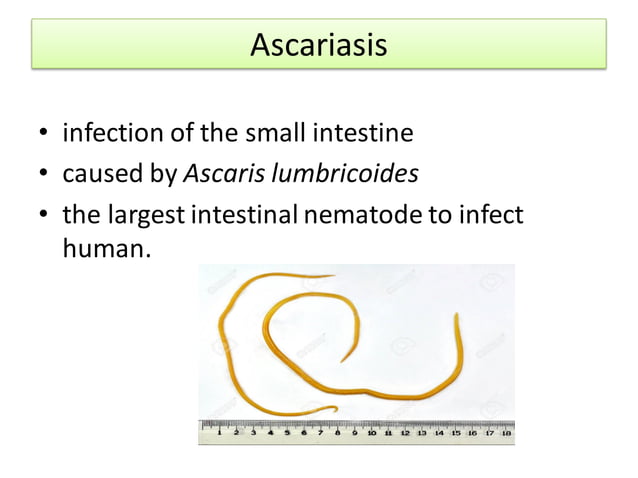 Ascariasis- Roundworm Infection | PDF | Infectious Diseases | Diseases ...