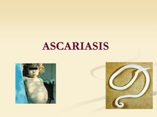 ASCARIASIS.............................................. | PPT