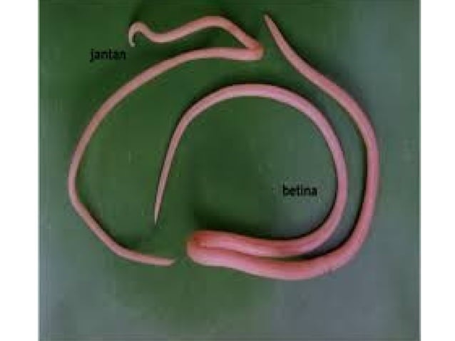 Ascaris lumbricoides is the most common parasitic worm in humans | PPTX ...