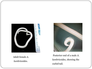 Ascariasis.pptx medical parasitology ppt | PPTX