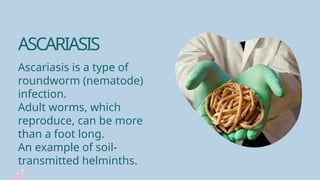 Microbiology: Ascariasis (Roundworm Nematodes).pptx