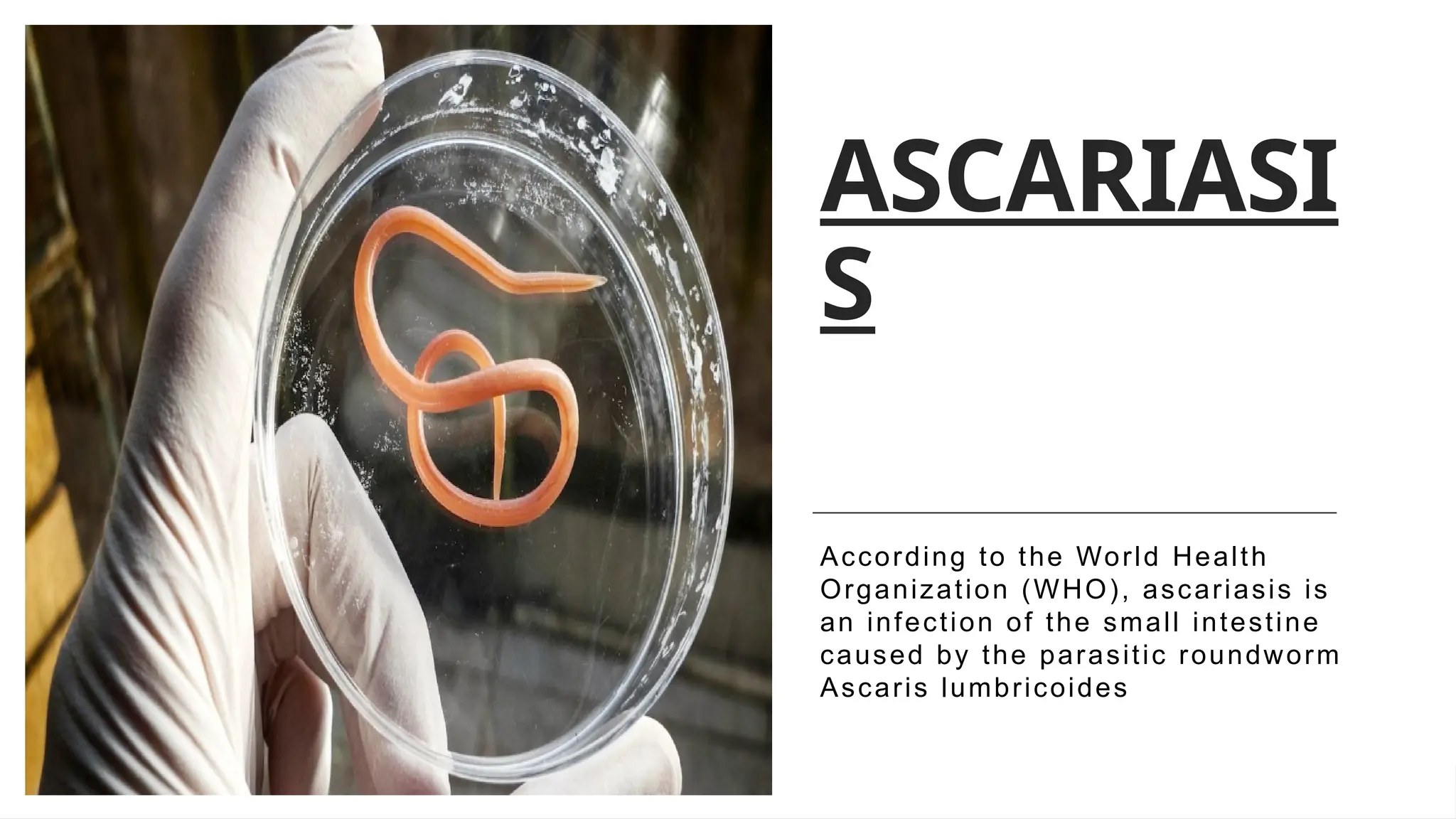 ASCARIASIS a disease of human that is destroying lives | PPTX