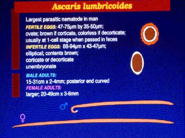 Ascaridiasi | PPT | Infectious Diseases | Diseases and Conditions