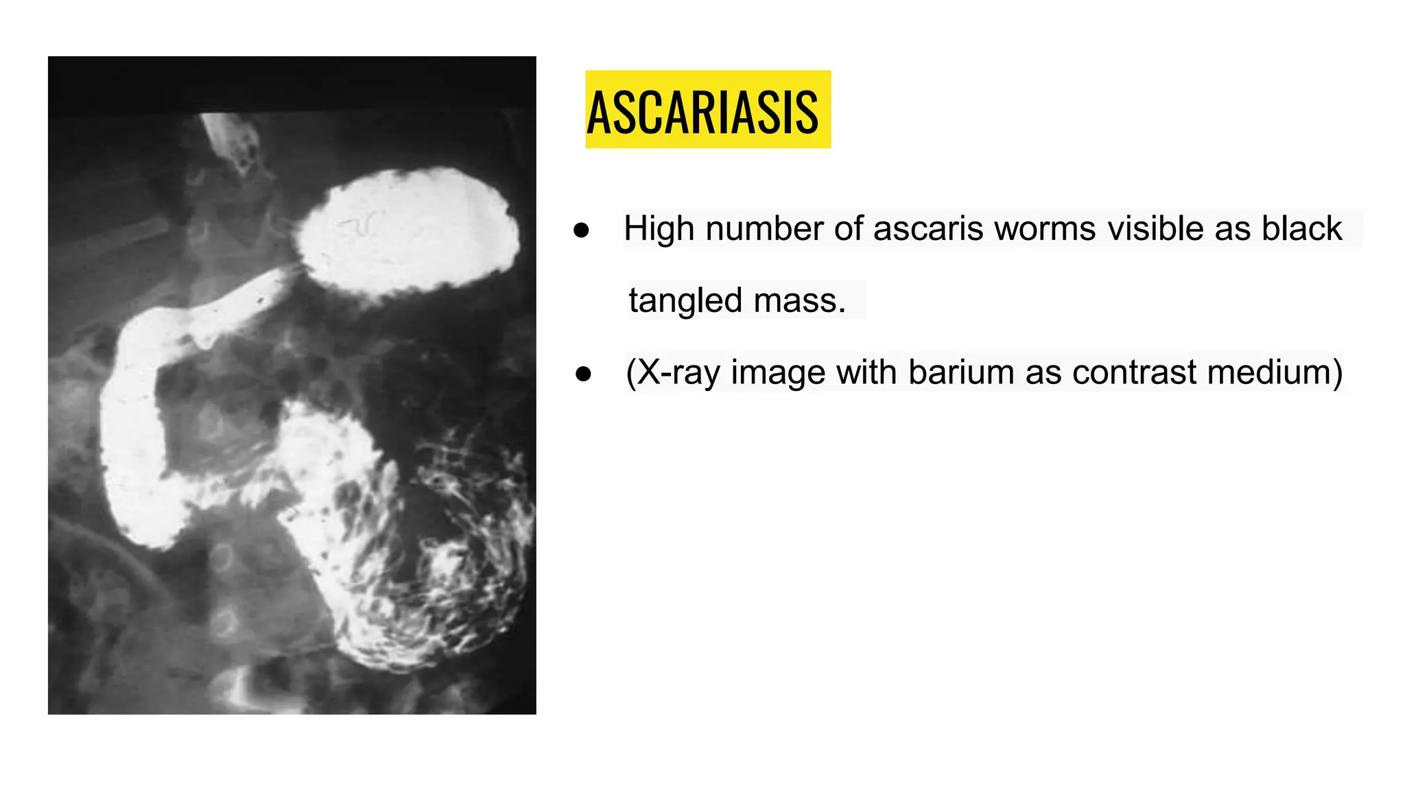 ASCARIS.pptx