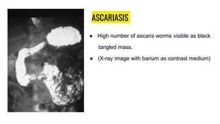ASCARIS.pptx