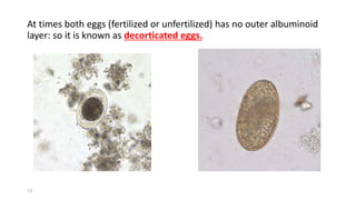 Ascaris Lumbricoides | PPTX