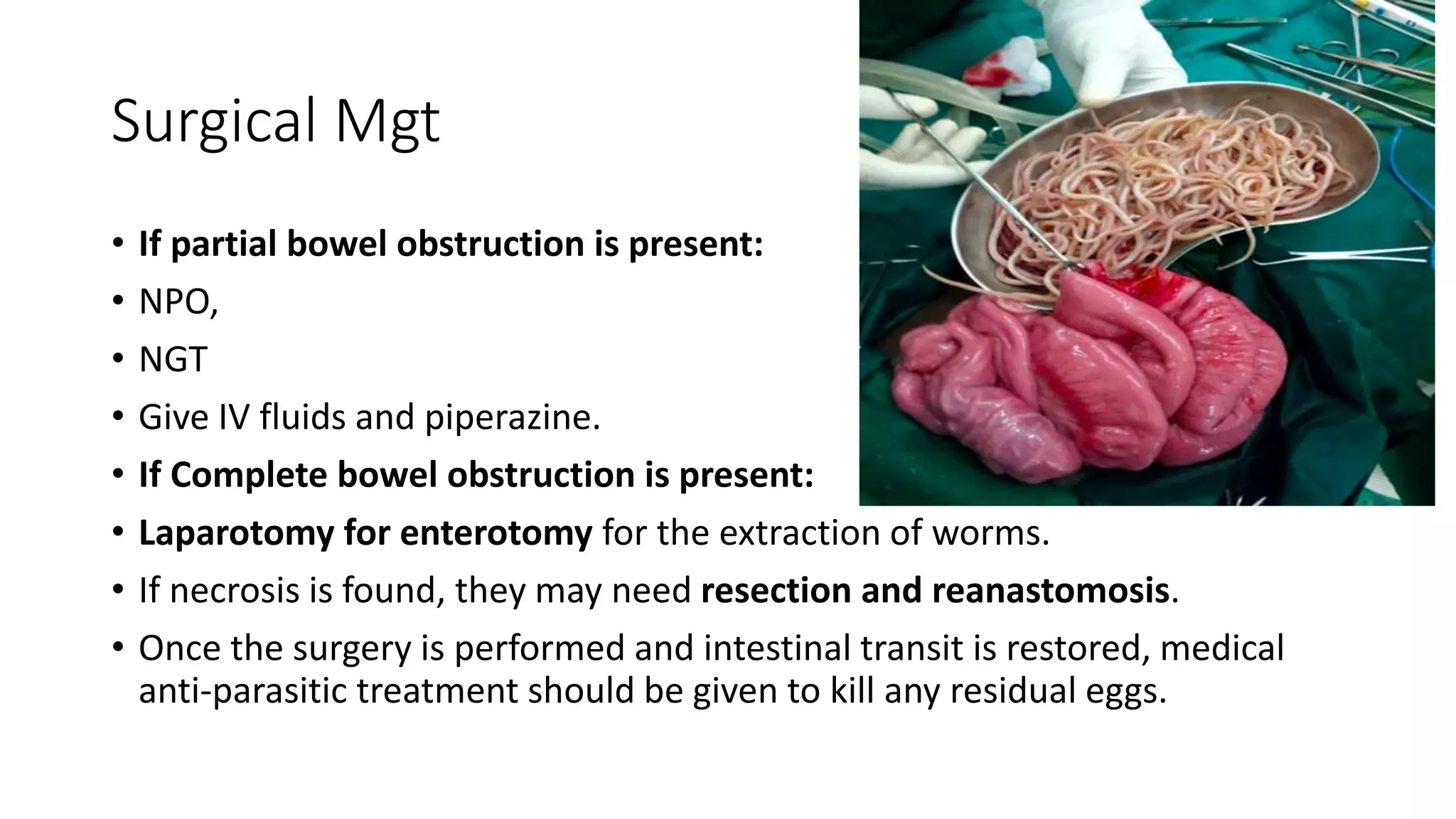 Ascaris and its surgical complications.pptx