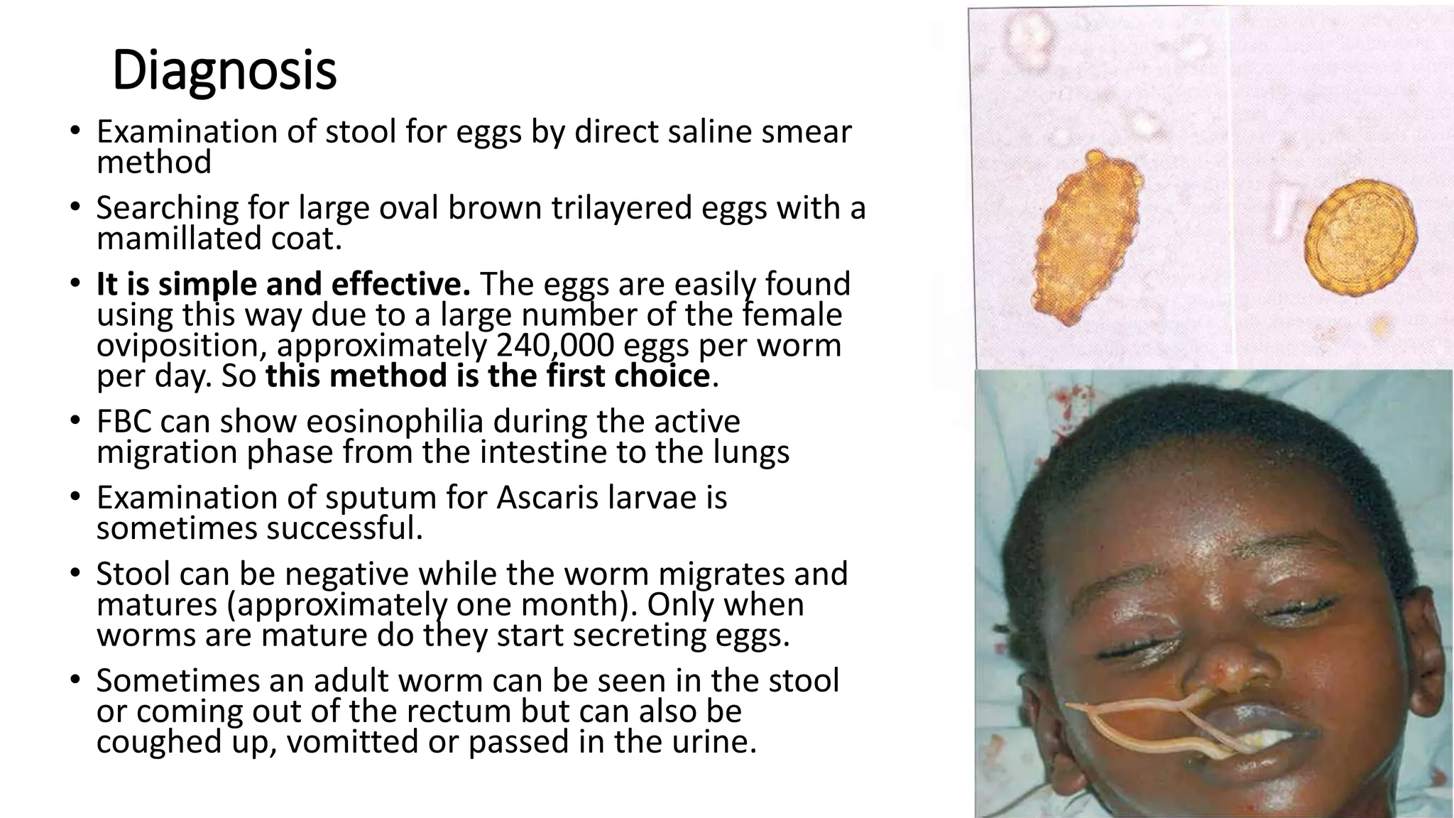 Ascaris and its surgical complications.pptx