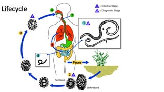 Ascaris and its surgical complications.pptx