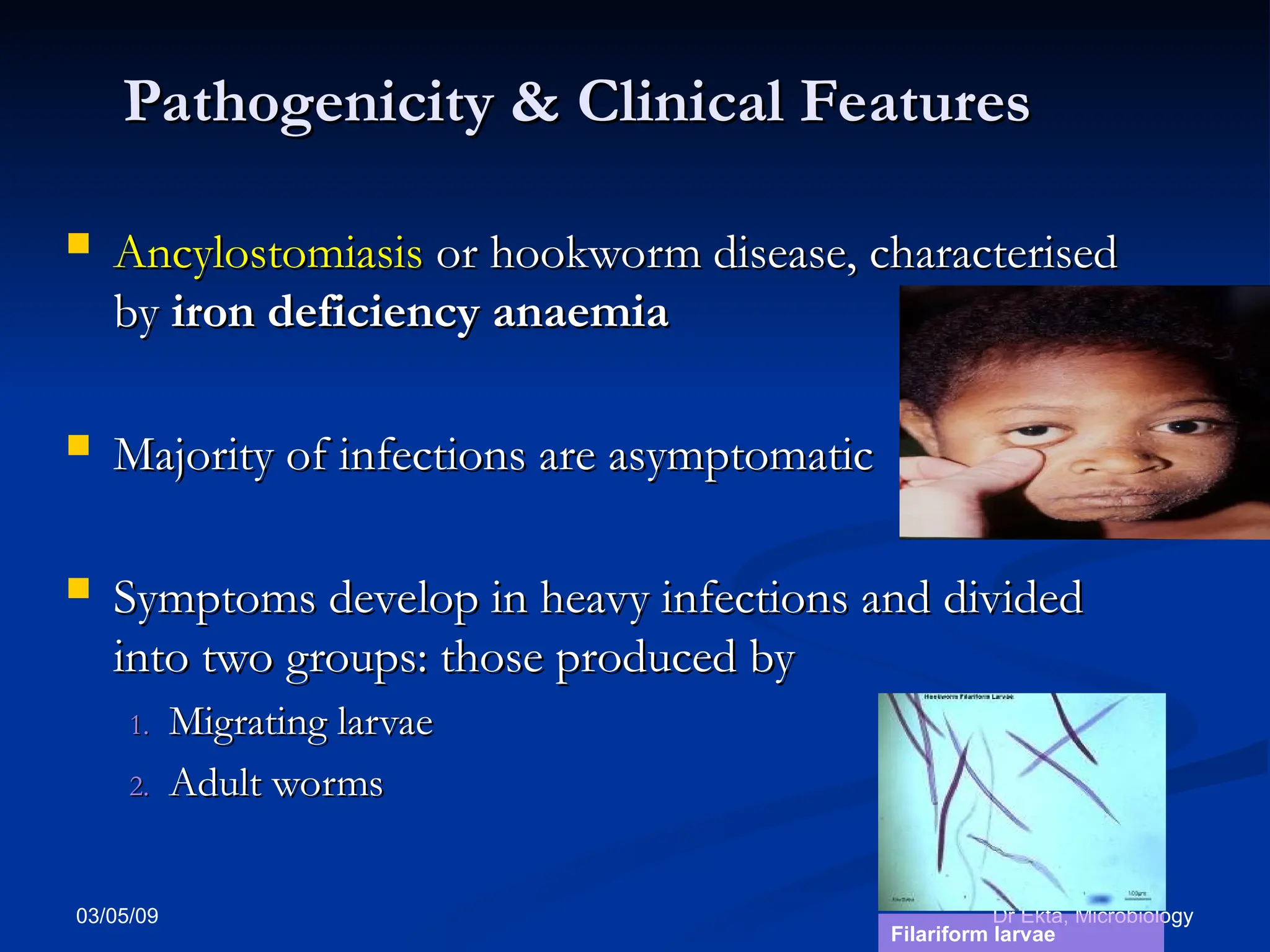 Ascaris, Enterobius, Hookworm and Trichrous 6.ppt