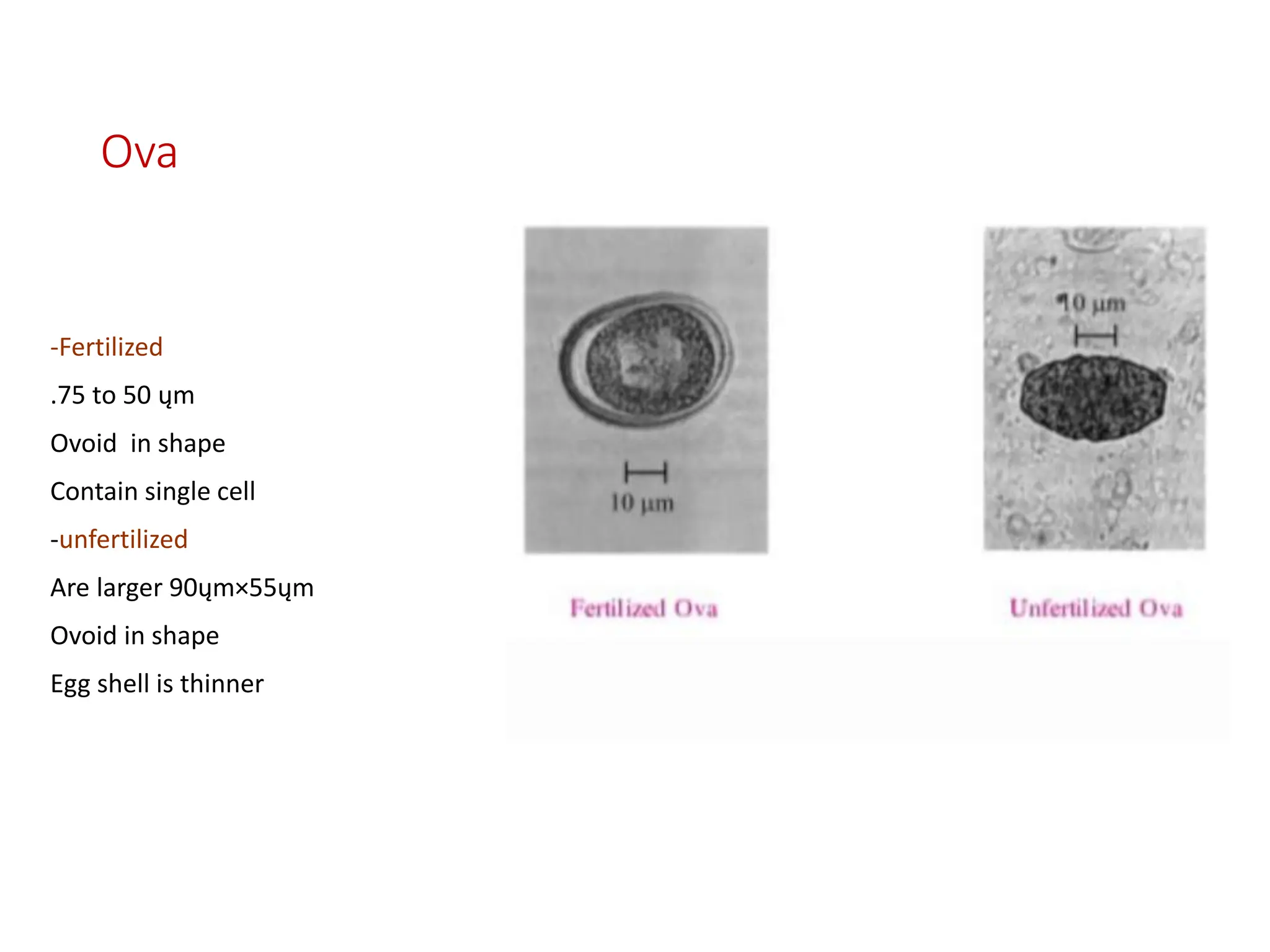 ASCARIS LUMBRIC-WPS Office.pptx