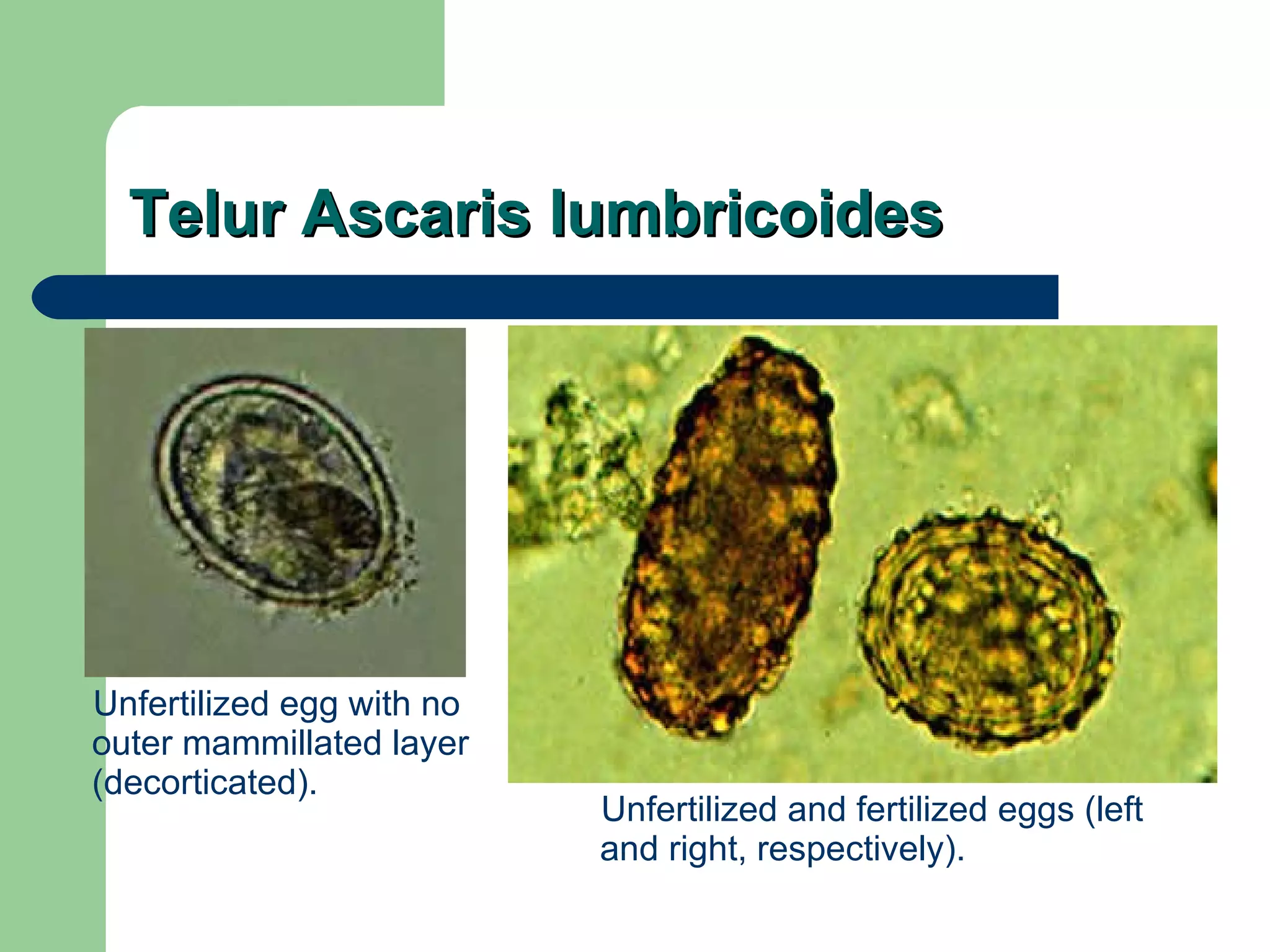Ascaris lumbricoides | PPT