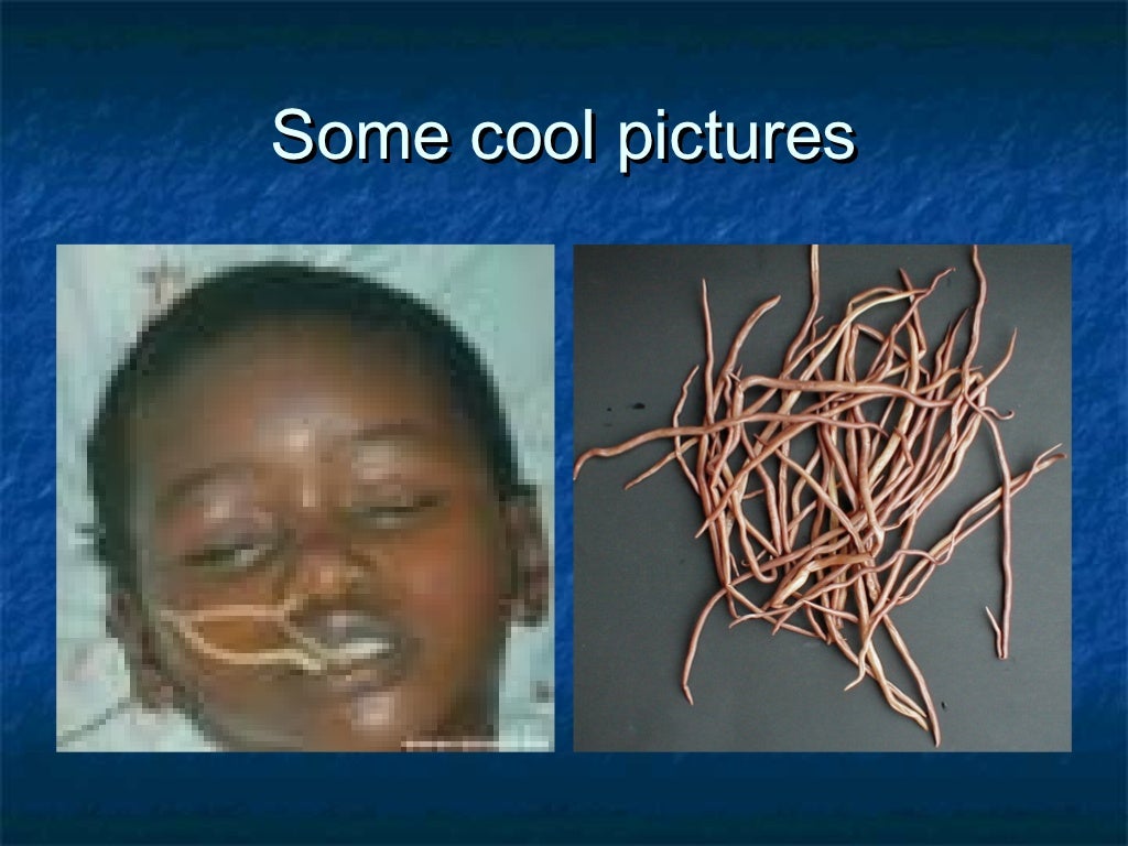 Ascariasis Lumbricoides