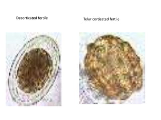 Ascaris lumbricoides | PPTX