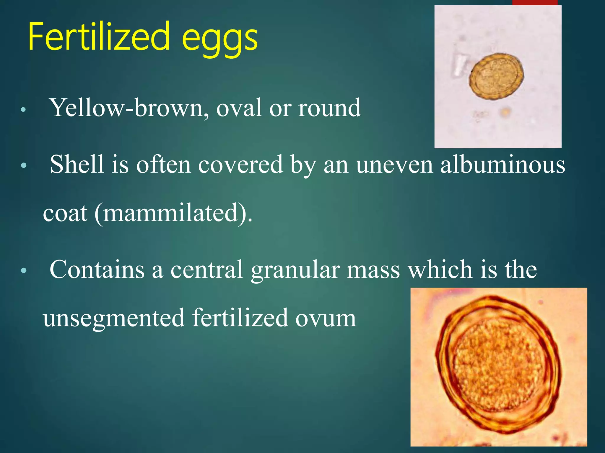 Ascaris lumbricoides | PPSX