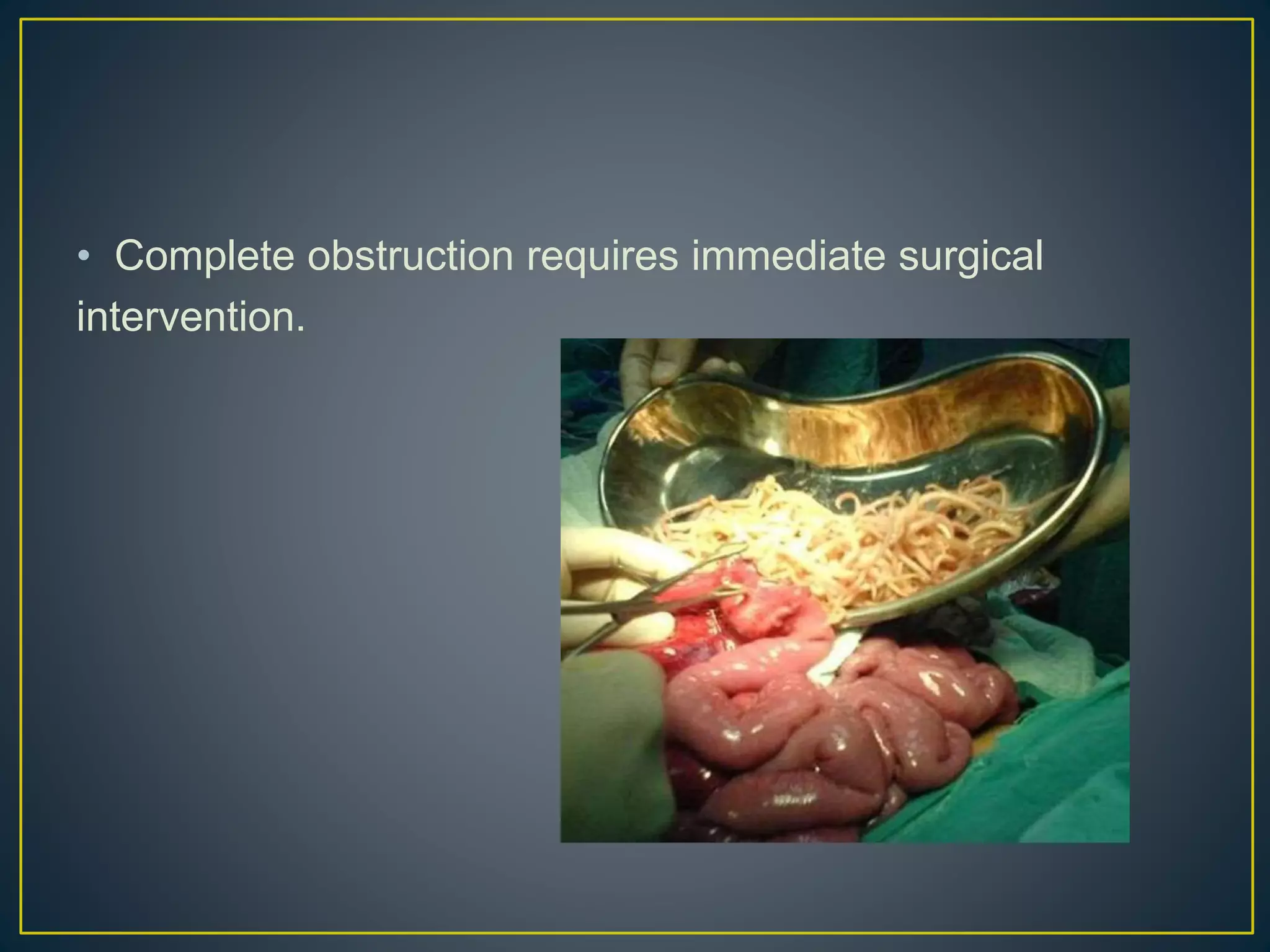 Ascaris lumbricoides | PPTX