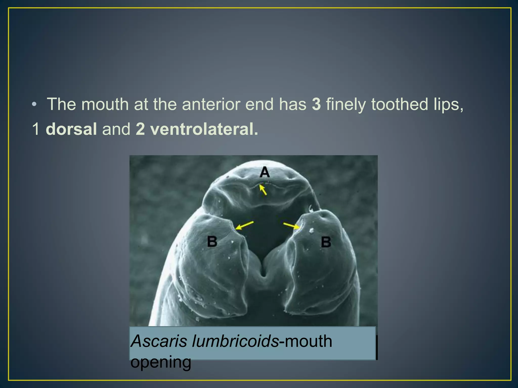 Ascaris lumbricoides | PPTX
