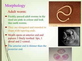 Ascaris lumbricoides | PPT