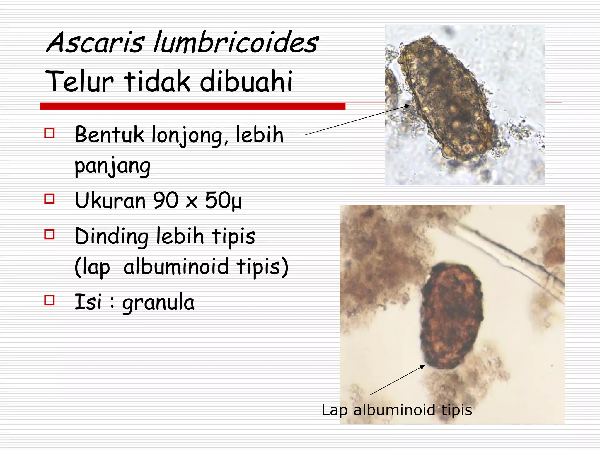 Ascaris Lumbricoides Dan Trichuris Trichiura | PPT