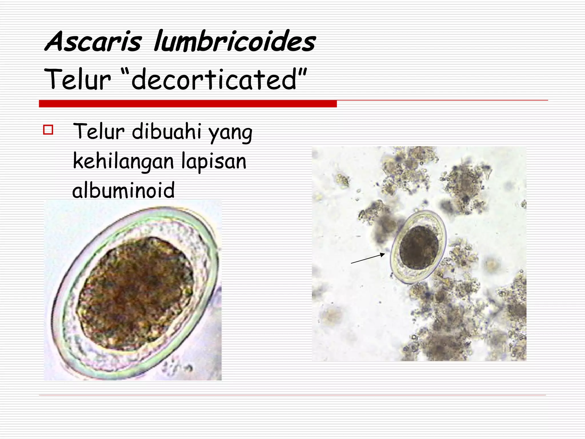 Ascaris Lumbricoides Dan Trichuris Trichiura | PPT