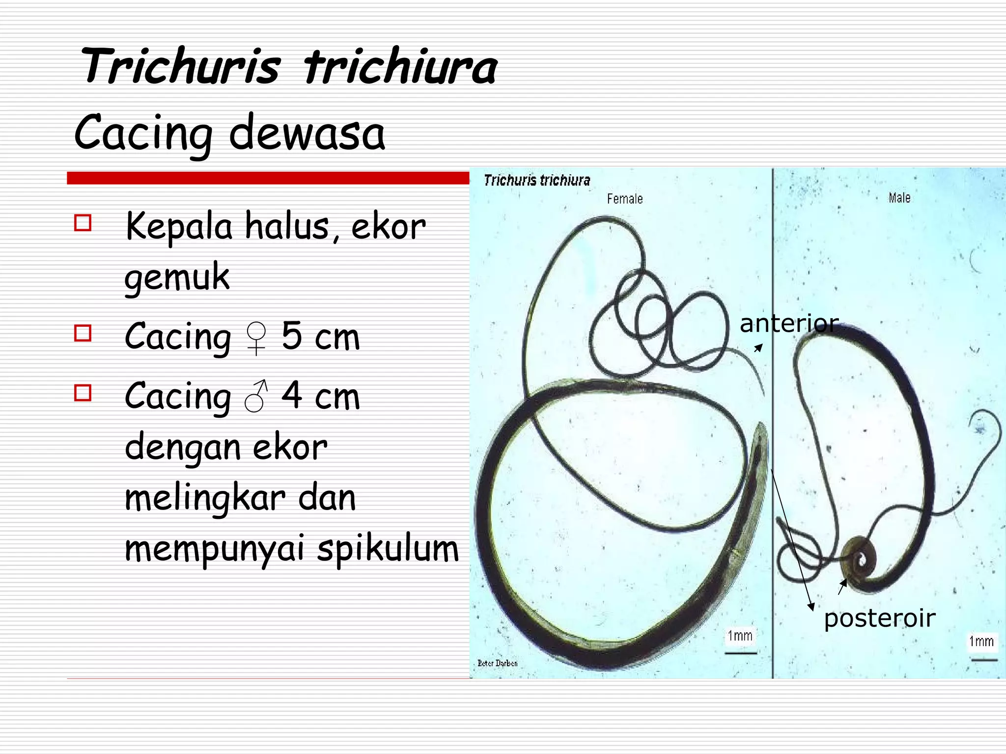 Ascaris Lumbricoides Dan Trichuris Trichiura | PPT