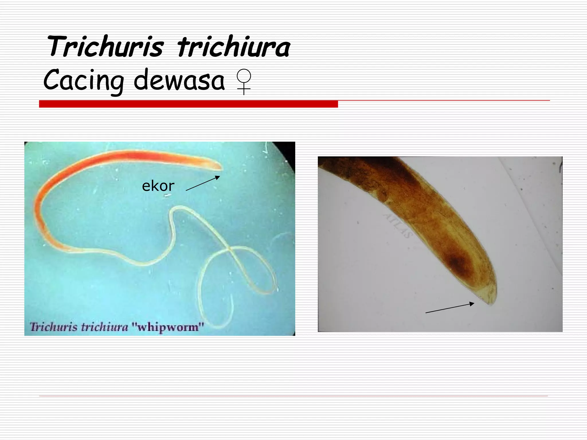 Ascaris Lumbricoides Dan Trichuris Trichiura | PPT