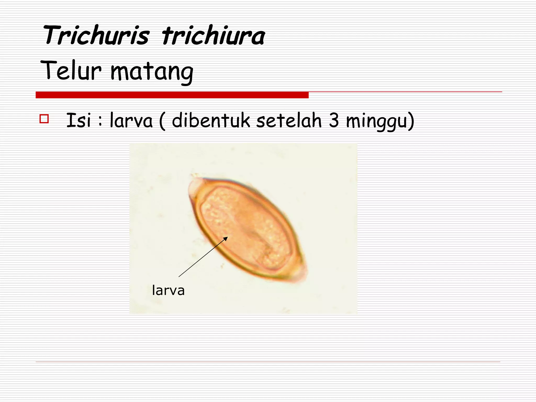 Ascaris Lumbricoides Dan Trichuris Trichiura | PPT