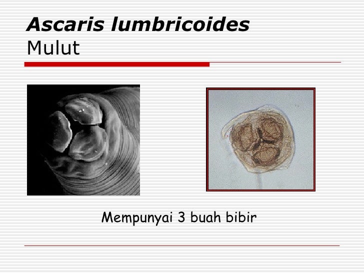 Ascaris Lumbricoides Dan Trichuris Trichiura
