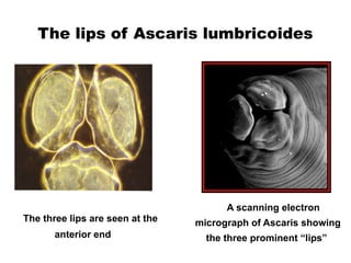 Ascaris lumbricoides by dr.janan 2024.pptx