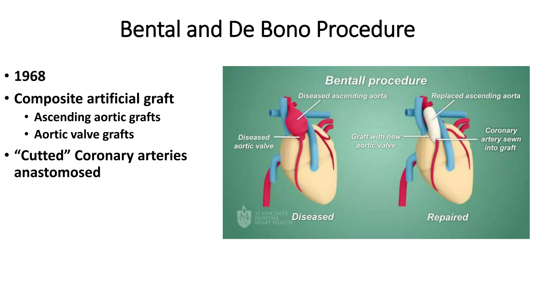 Ascending aorta surgical repair techniques | PPTX | Heart and ...