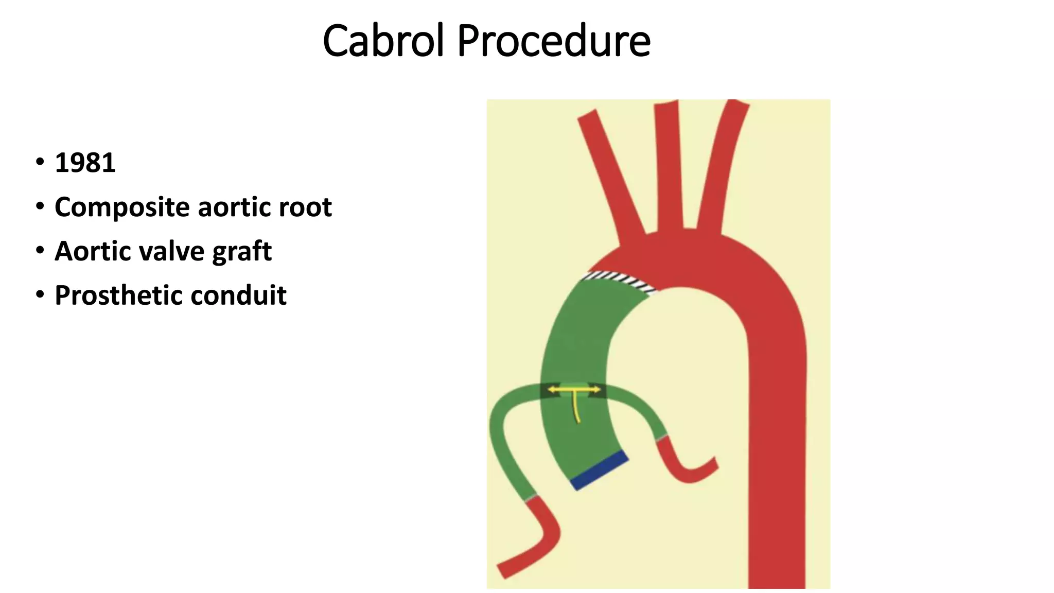 Ascending aorta surgical repair techniques | PPTX | Heart and ...
