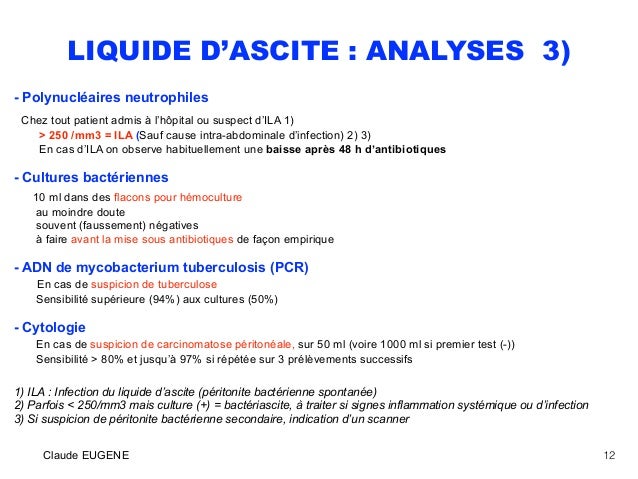 Ascite Conduite du diagnostic