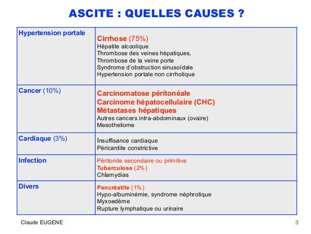 Ascite Conduite du diagnostic