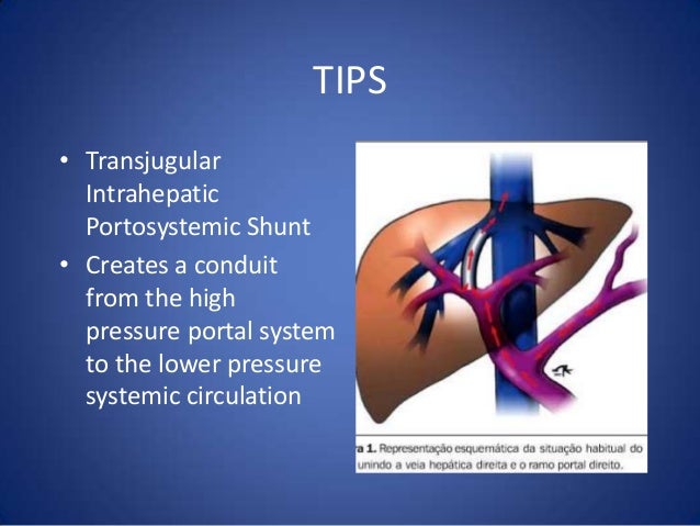 Ascites and SBP