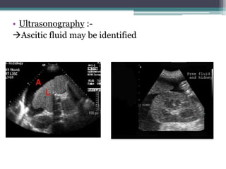 Ascites in domestic animals | PPTX