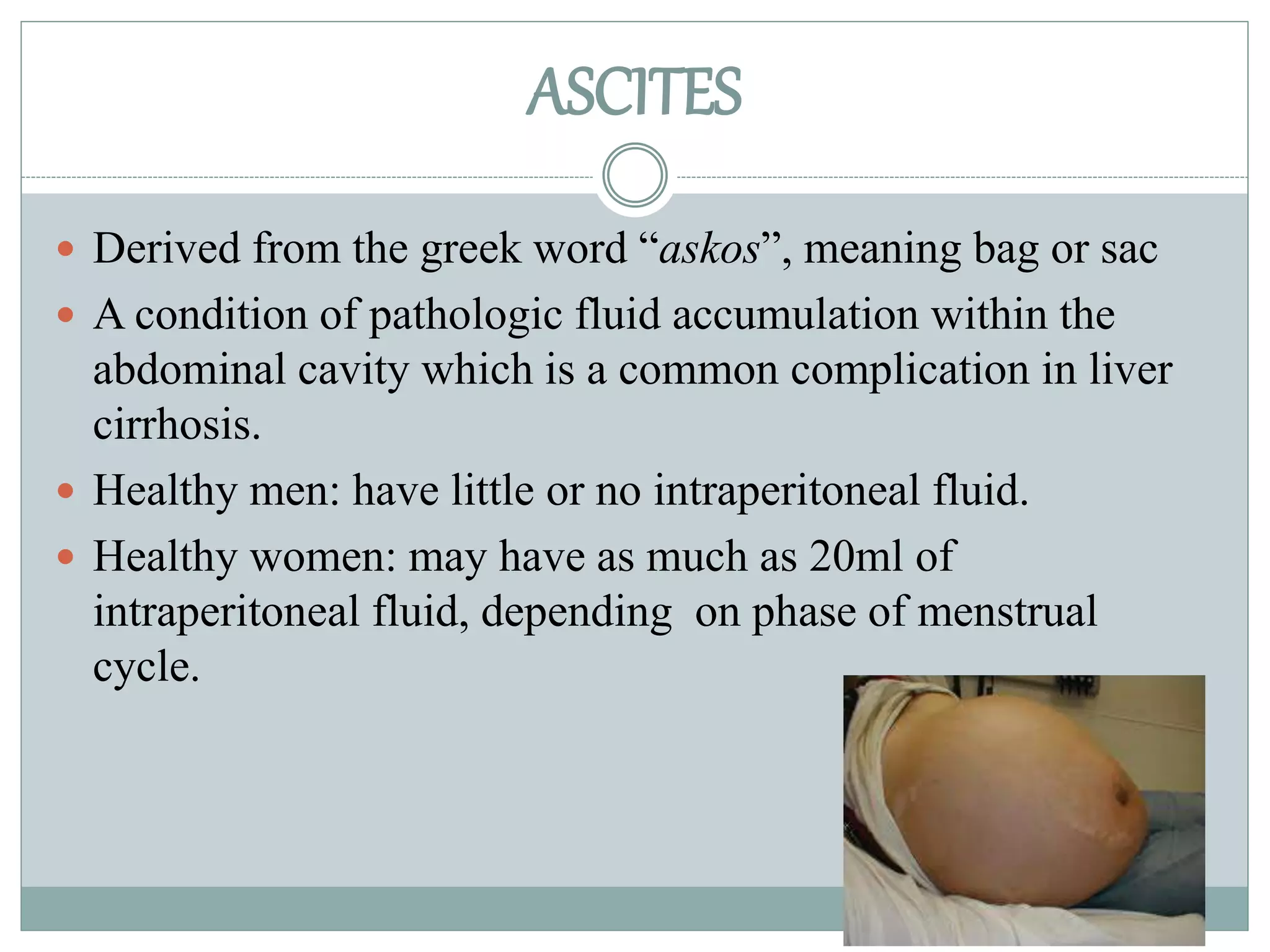 Ascites | PPTX