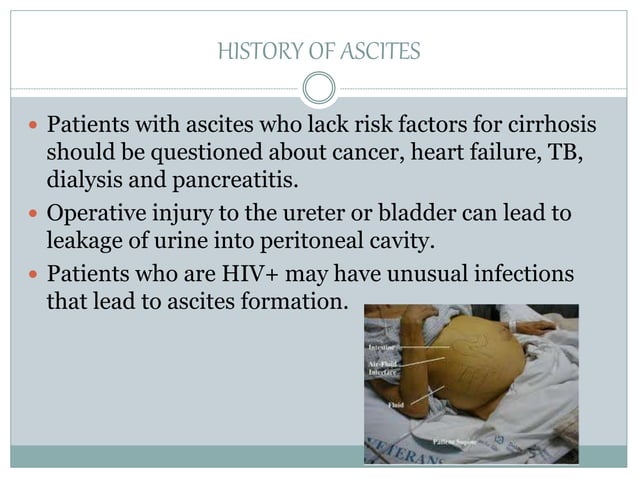 Ascites | PPT