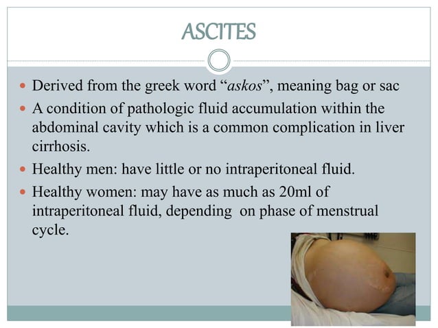 Ascites | PPT